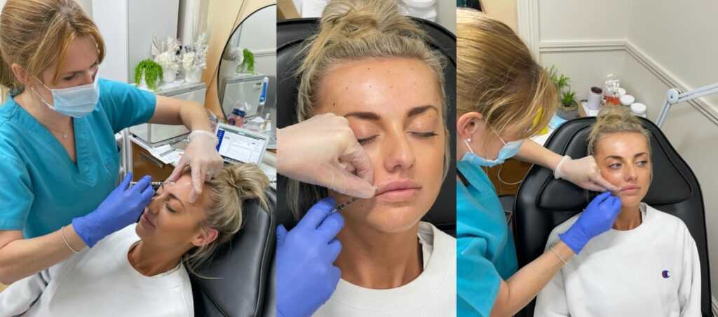 Double chin injections - Dr Lindsay Moran